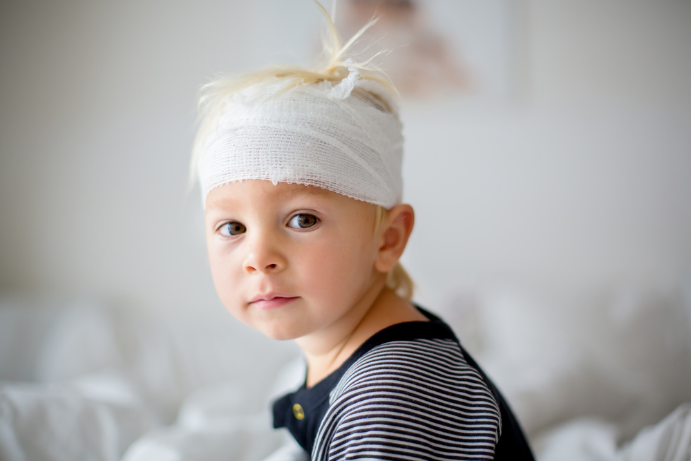 The Ultimate Guide to Preventing Kids’ Head Injuries After Falls - Bomb ...